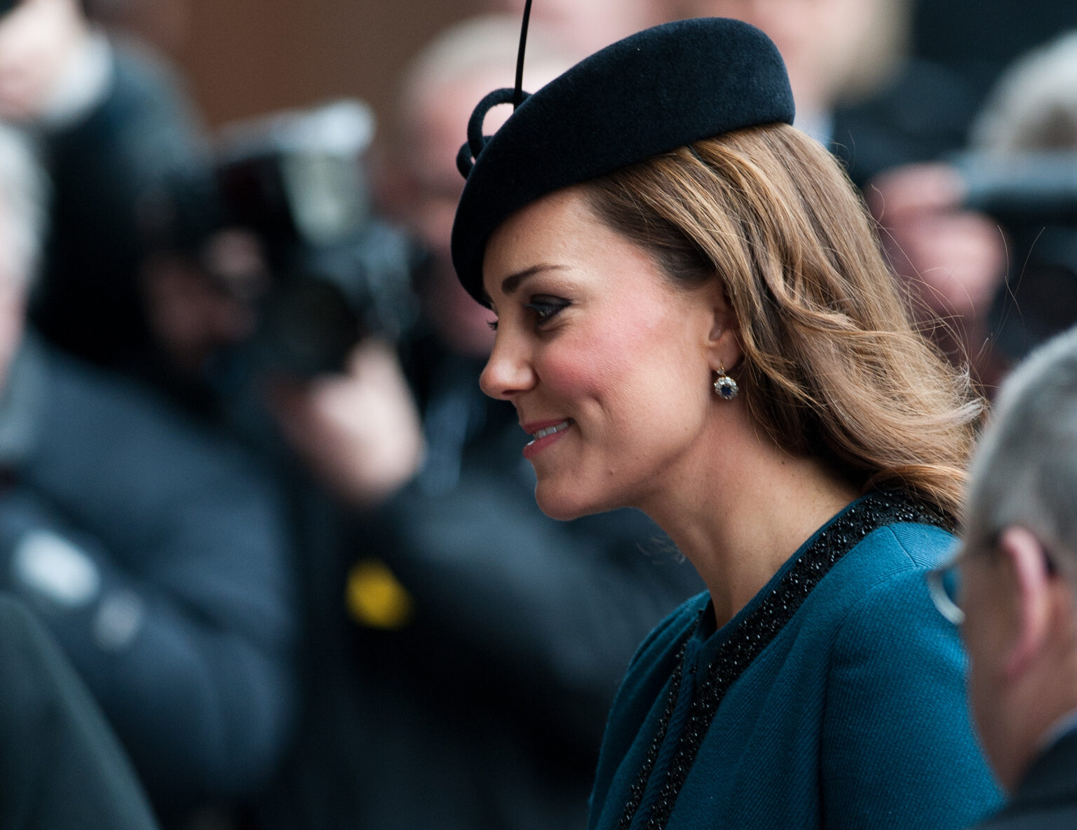 Kate Middleton health: Mystery three-inch head scar, childhood ...
