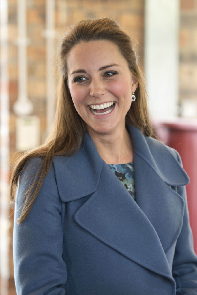 Kate Middleton health: Mystery three-inch head scar, childhood ...