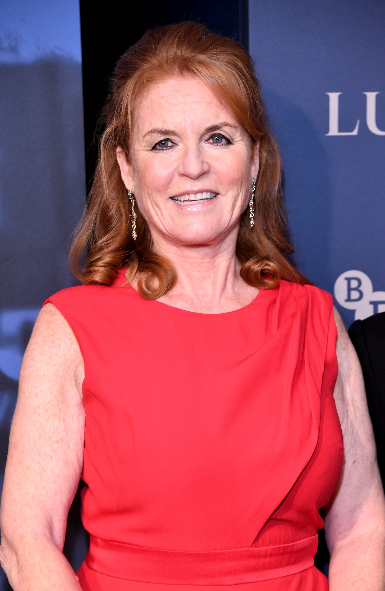 Sarah Ferguson before and after cosmetic treatments from 'Botox' to filler